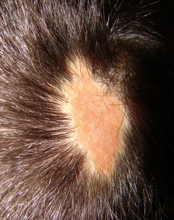 SEBACEOUS NEVUS